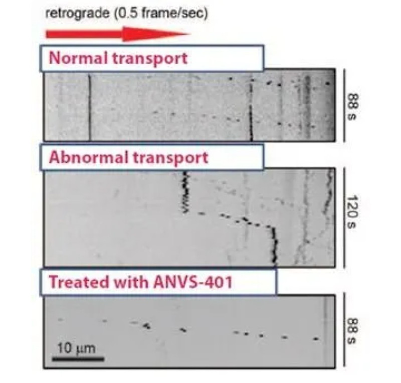 [미국 주식] Annovis Bio Inc (ANVS) 주가가 급등한 이유는?