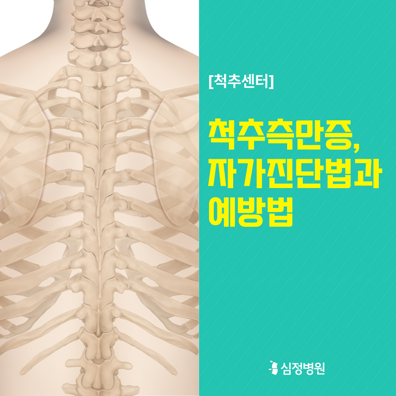 현대인의 고질병 척추측만증, 집에서 쉽게 할 수 있는 자가진단법과 예방법