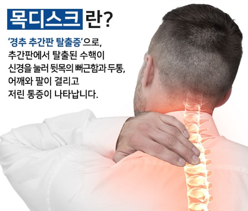목디스크 자가진단 및 증상 원인 치료