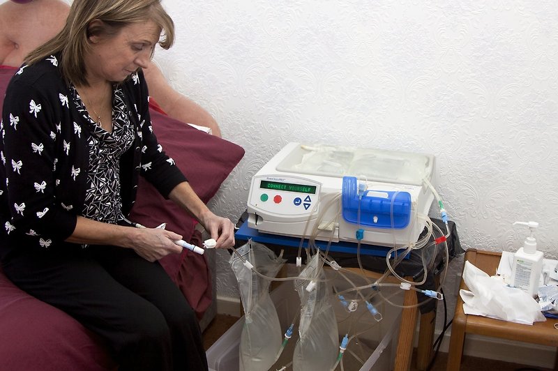 Automated Peritoneal Dialysis= APD