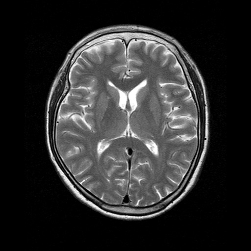 뇌 MRI 검사 비용과 건강보험 적용을 한 번에 알아보기