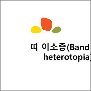 띠 이소증(Band heterotopia) 알아보기