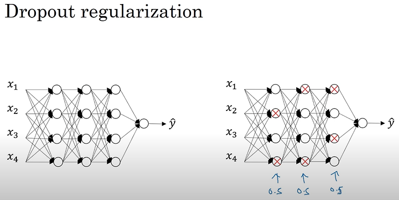 Dropout Regularization (C2W1L06)
