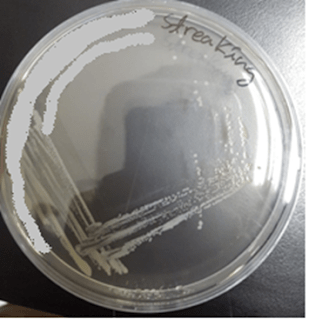 [생물공학실험]Inoculation and Culture for Microbes (Streaking and Spreading) - 킬리안 스토리