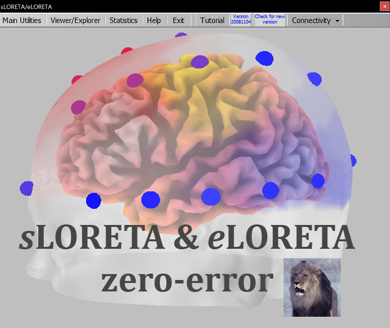 [sLORETA] sLORETA에 대하여
