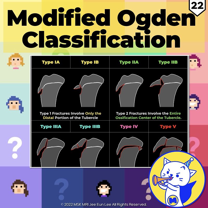 (Fig 4-B.22) Modified Ogden Classification