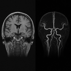 MRI와 MRA, 같은 듯 다른 검사! 정확히 알고 받으세요 :: 꿈꾸는 마미