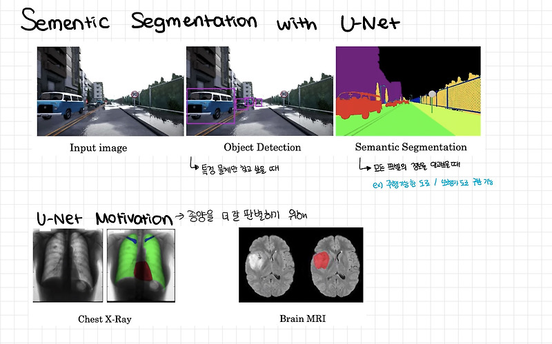 [Deep Learning] CNN week3-3. U-Net Architecture for Semantic Segmentation using Transpose ...