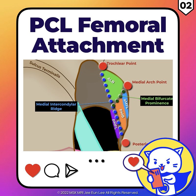 (Fig 2-E.02) Femoral Attachment Of The PCL ⎜ Meniscofemoral Ligaments ...
