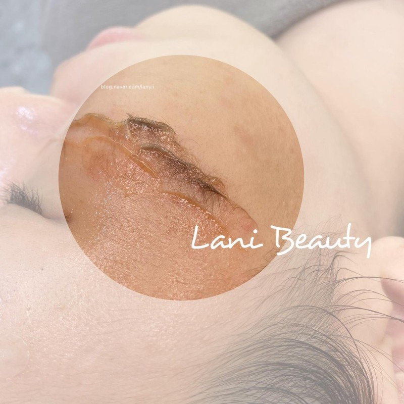 일산 스킨플래닝 And 더마플래닝 맛집 라페스타 라니뷰티 ️ 부작용 걱정은 No 잘하는곳 찾으신다면 바로 요기👆🏻 물광피부