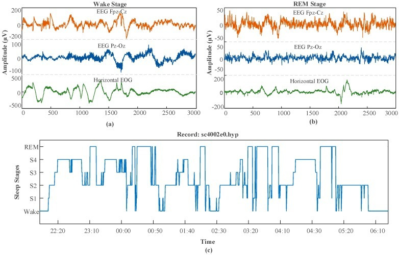 [Deep Learning] A Deep Learning Model for Automated Sleep Stages Classification Using PSG Signals