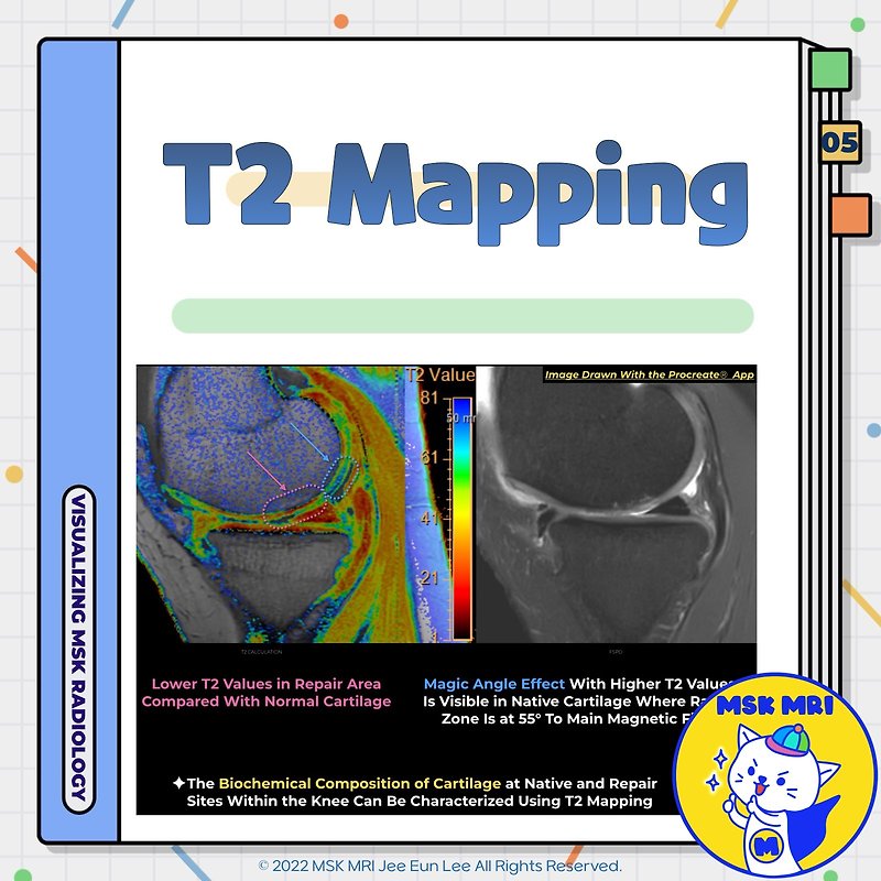 (Fig 5-A.05) T2 Mapping Techniques
