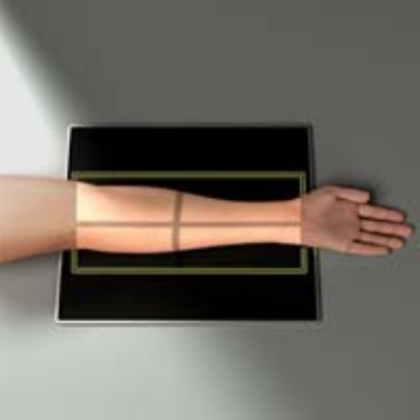 방사선 일반촬영 기법 (Forearm AP projection)에 대해서 알아봅시다.