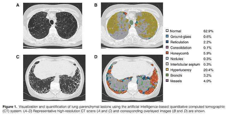 Handa et al., 2022, Novel Artificial Intelligence-based Technology for ...