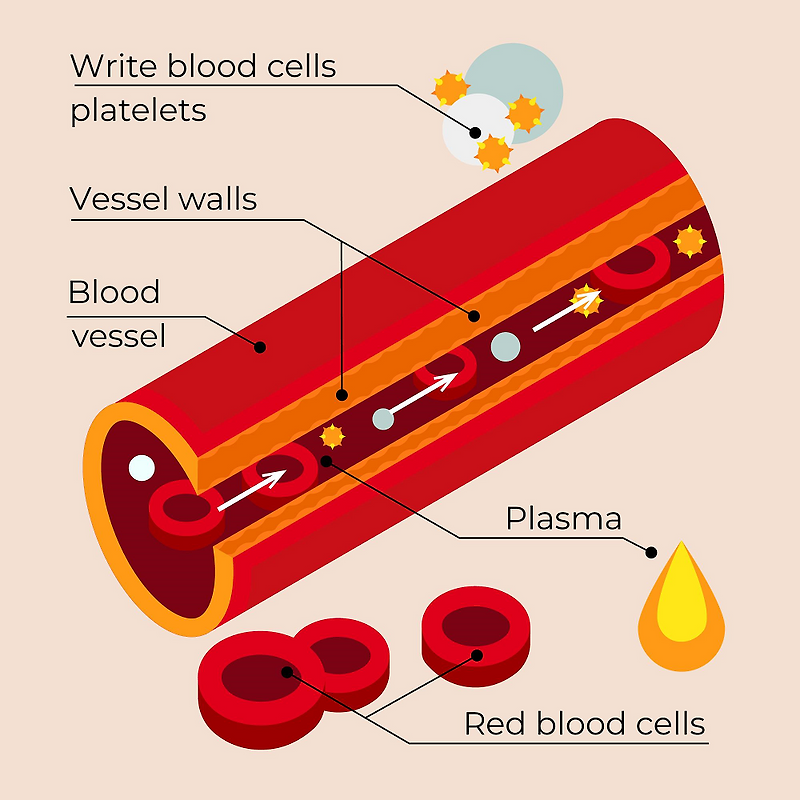의학 정보, 혈장 교환술(therapeutic plasma exchange) 원리와 사용 및 치료