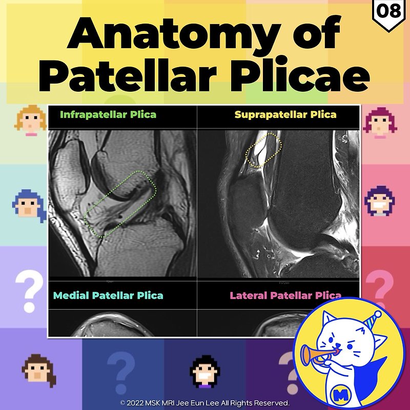 (Fig 4-C.08) Anatomy of Patellar Plicae