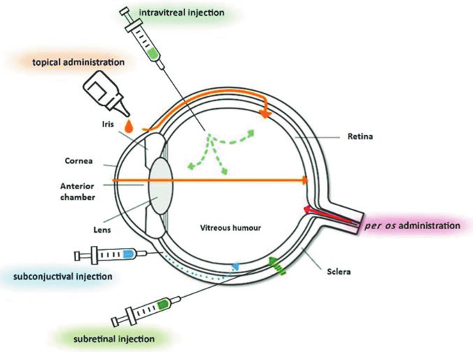Types of Eye Injections