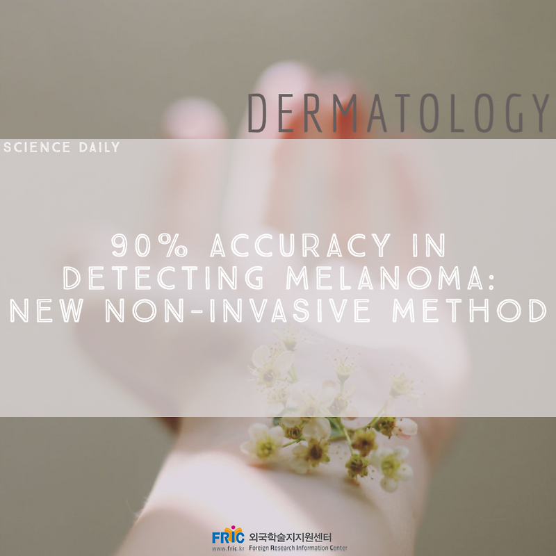 [Dermatology] 90% accuracy in detecting melanoma: New non-invasive method