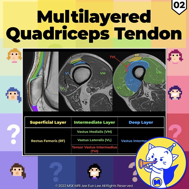 (Fig 4-B.02) Anatomy of the Multilayered Quadriceps Tendon/ Part 2
