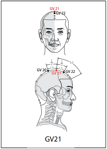 [경혈검색] 독맥 (GV) > GV21 전정 (前頂)