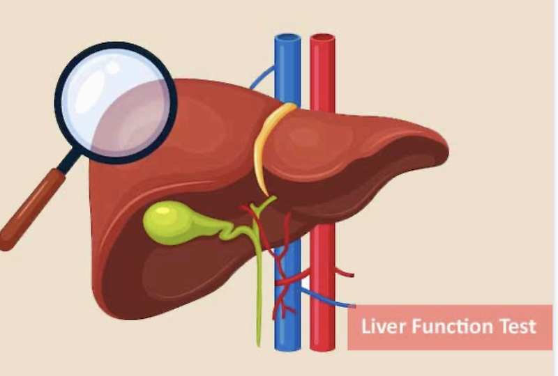간기능 검사 (LFT,liver function test) :: ultrasound study