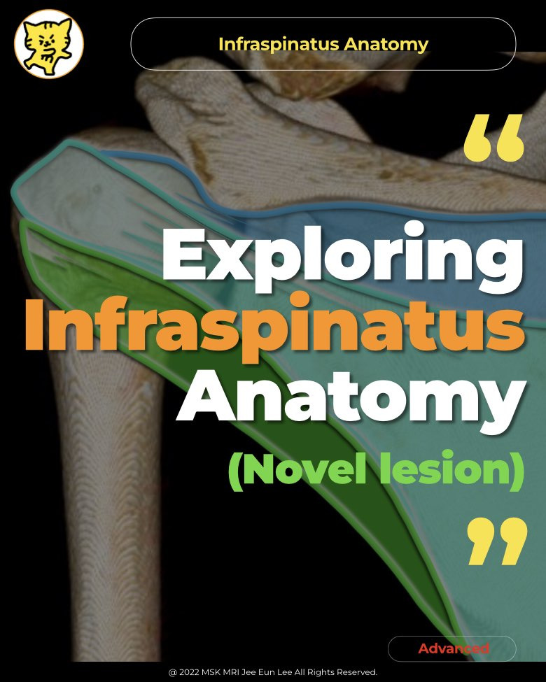 Understanding Infraspinatus Tendon Anatomy_ Key Insights for MRI