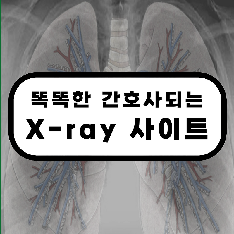 Chest X-ray 공부하는 방법(사이트 추천)