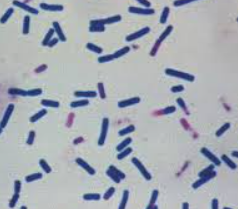 그람양성간균 (GPR : Gram Positive Rods)