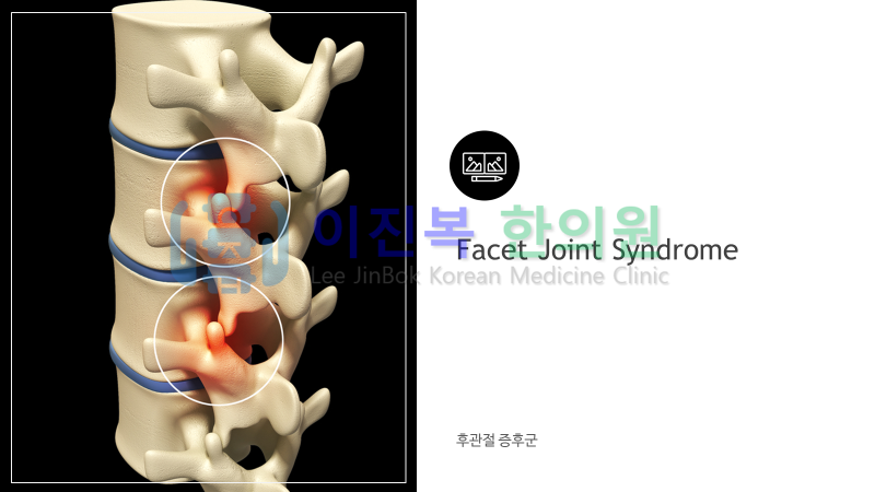 전주 이진복한의원 후관절증후군