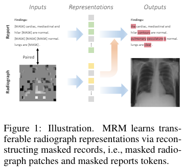 [논문 리뷰] Advancing Radiograph Representation Learning with Masked Record ...