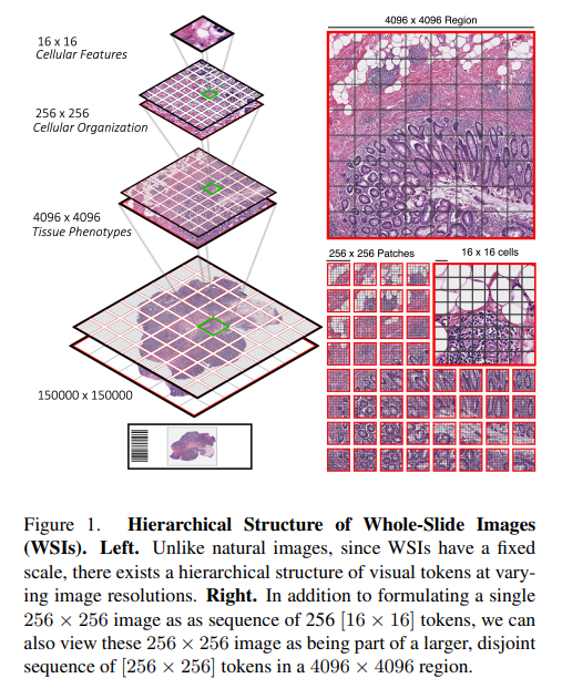 Scaling Vision Transformers to Gigapixel Images via Hierarchical Self-Supervised Learning 정리