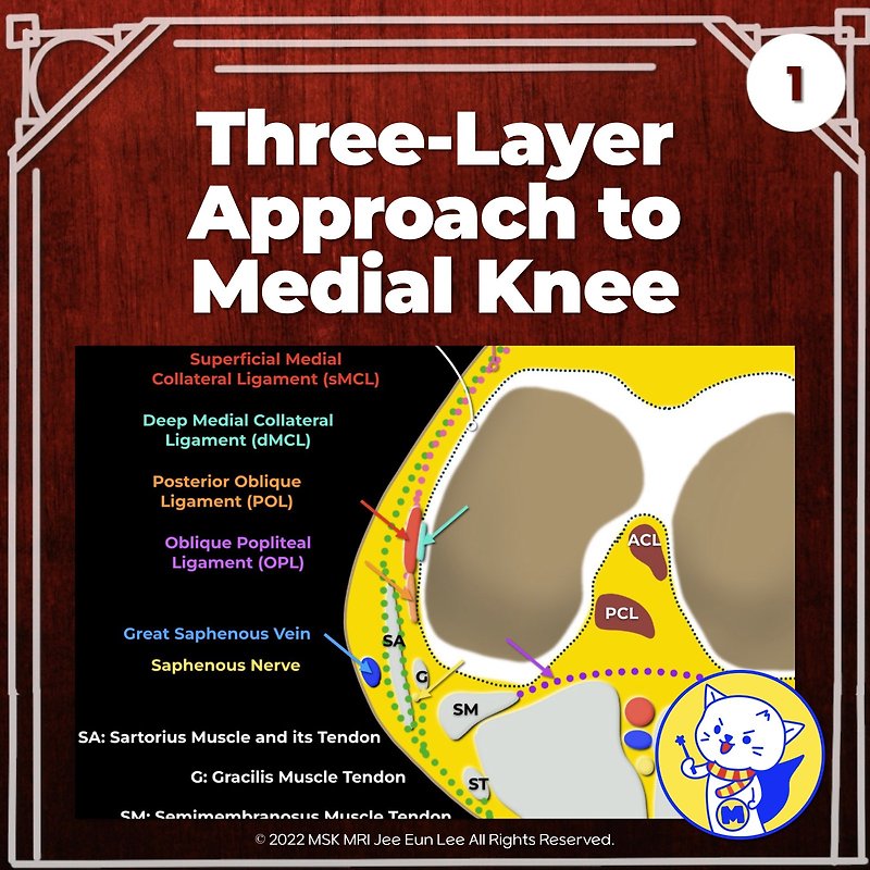 (Fig 3-A.01) Three-Layer Approach to Medial Knee