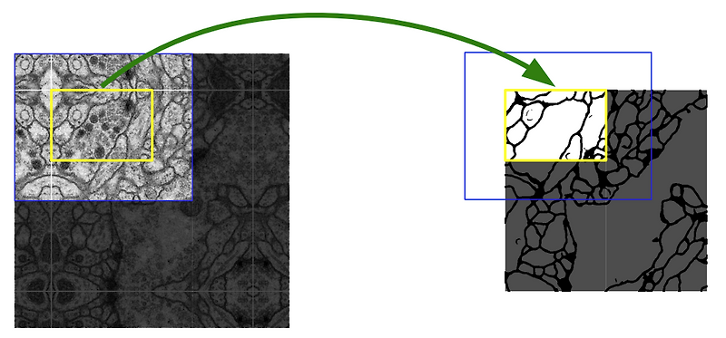 U-Net: Convolutional Networks for BiomedicalImage Segmentation(UNet)(2015) Review