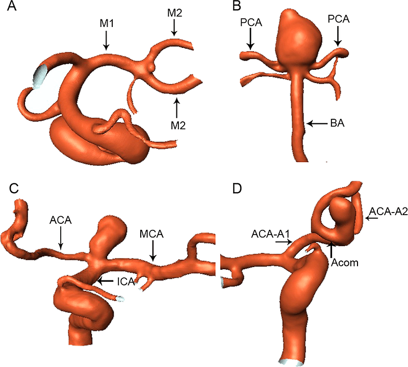 MCA의 M1, M2/ACA의 A1,A2/PCA의 P1,P2