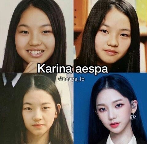AESPA Karina Plastic Surgery? Rumor Proof Pics | KpopCelebs