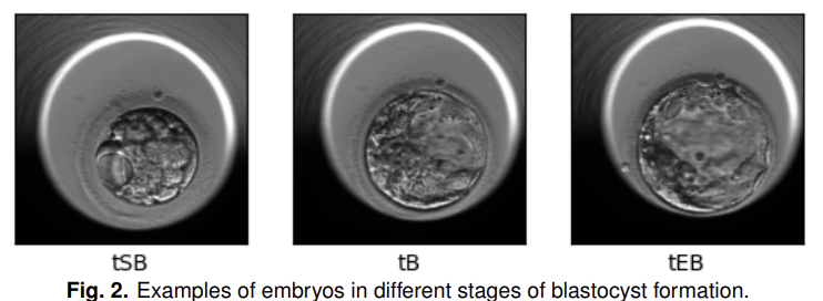 Assisted Reproductive Technology Dataset of Embryo Time-lapse Images ...