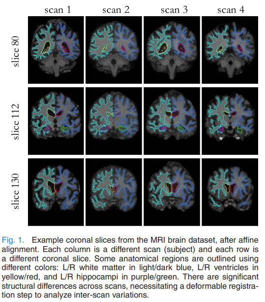 [YNY] VoxelMorph: A Learning Framework for Deformable Medical Image Registration — SUDAL