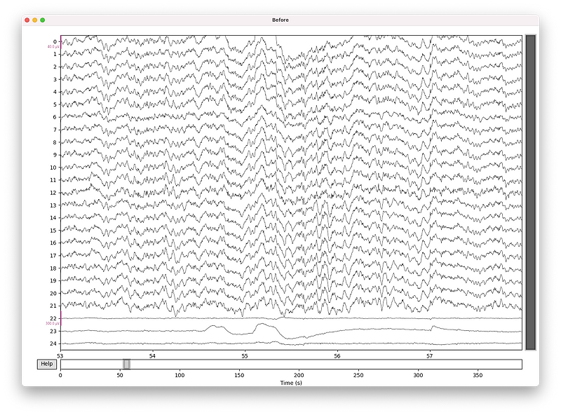 [MNE-Python] 선형회귀를 이용하여 EEG 신호에서 안구 운동 제거