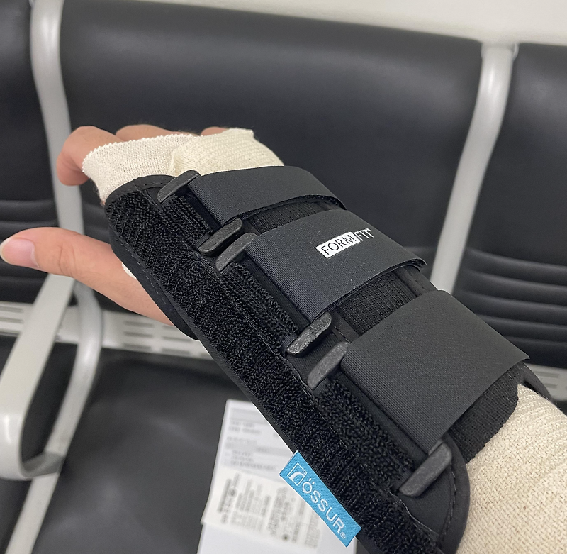 TFCC 수술 후기 #5