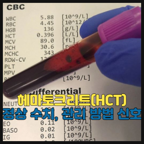 헤마토크리트(Hematocrit, HCT) 정상 수치, 관리 방법 및 위험 신호