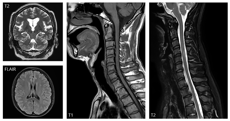 연말과 MRI :: The Field Of Kuseel
