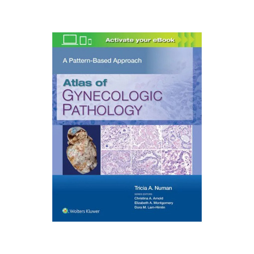 Atlas of Gynecologic Pathology: A Pattern-Based Approach,1/e