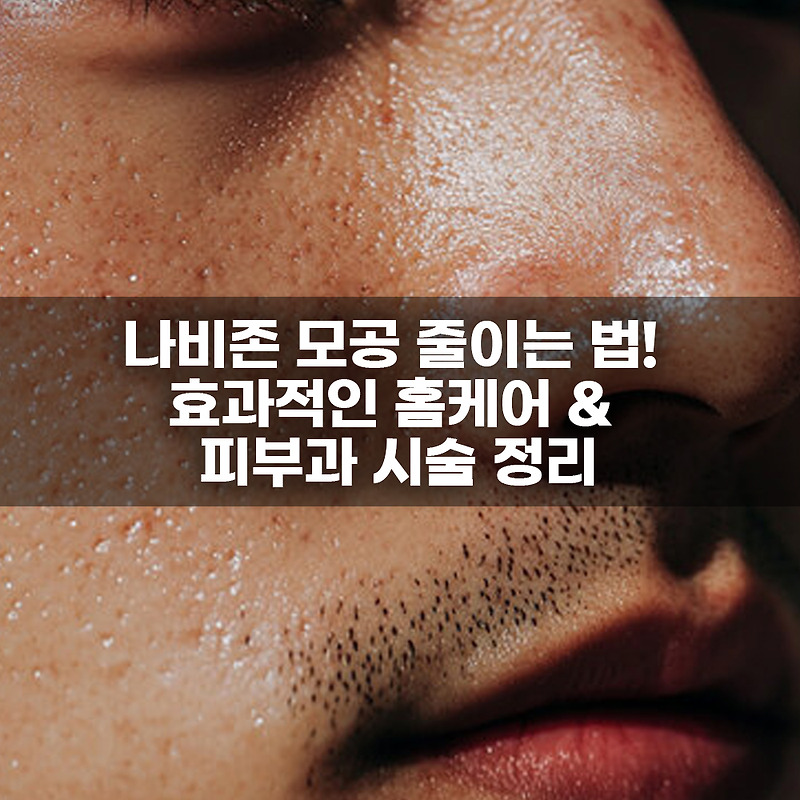 나비존 모공 줄이는 법! 효과적인 홈케어 & 피부과 시술 정리