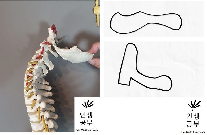 목 X-RAY 보는 방법(How to Read a Cervical X-ray) - 선 긋는 방법 : 목뼈(CERVIAL ...