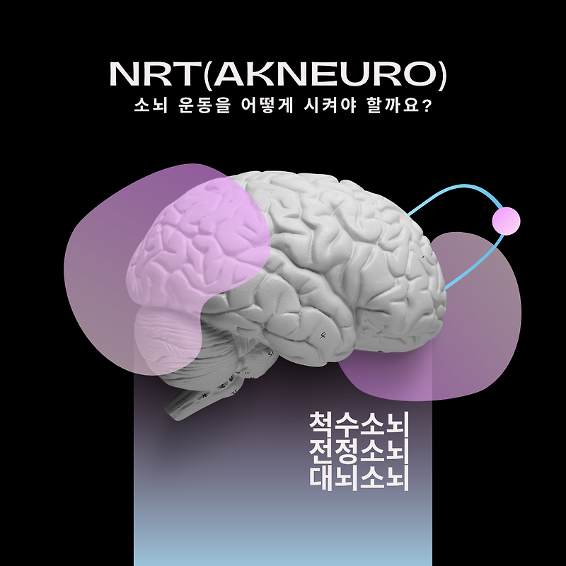 소뇌 트레이닝은 어떻게 해야 하는가