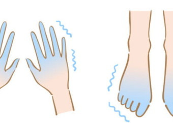 한여름에도 손발이 시려운 '수족냉증'에 대해 알아보기