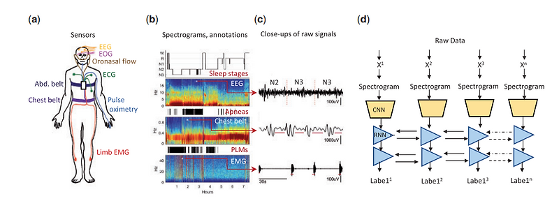 논문 요약 - Expert-level sleep scoring with deep neural networks