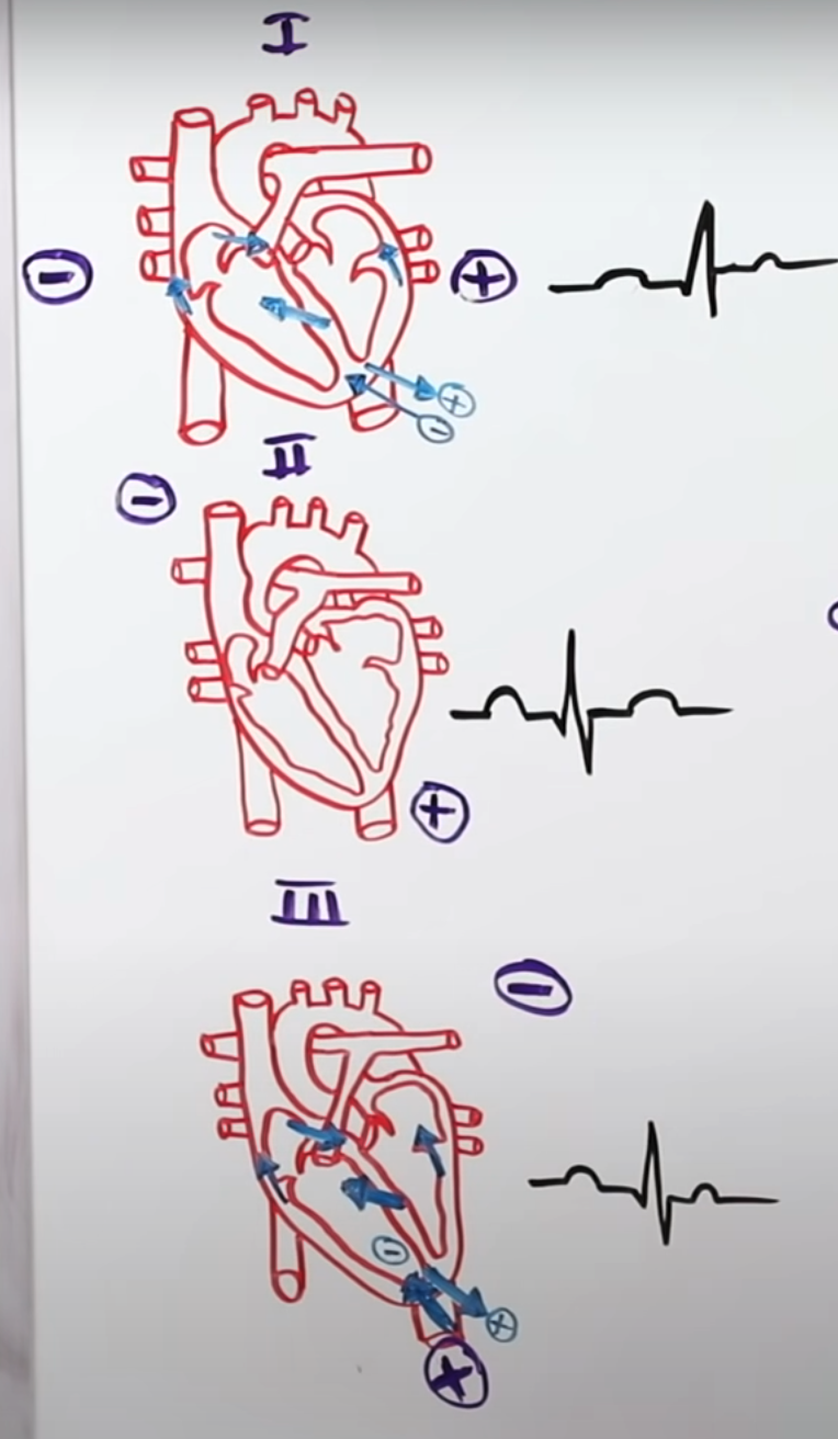 EKG Basics :: 공부방
