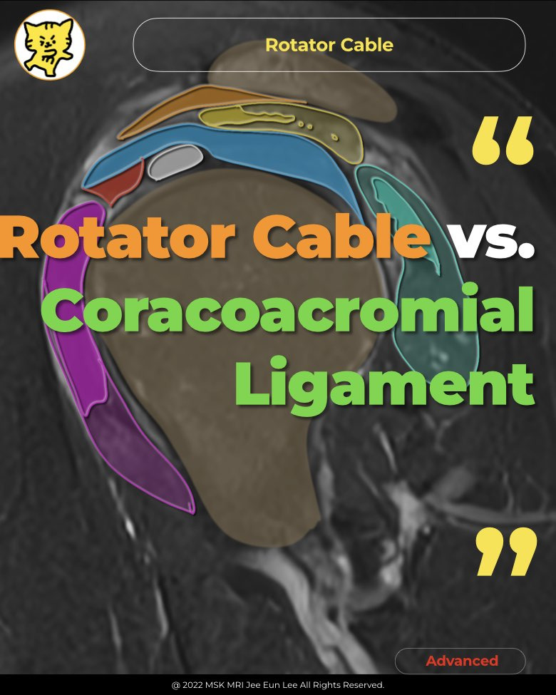 Rotator Cable vs. Coracoacromial Ligament on MRI: How to Avoid Common ...