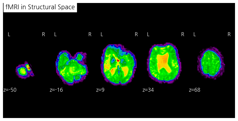 [Medical] - FSL로 fMRI 와 MRI 데이터를 분석해보자